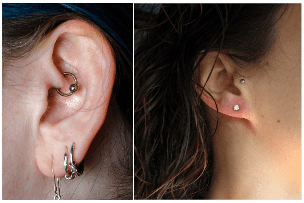 Ear And Nose Piercing in Dhaka - ENT Care Center